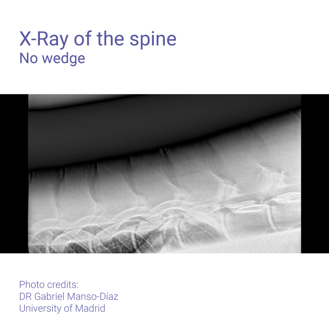 Aluminium Wedge - Equine NeckBack X-ray Wedge Podoblock B.V.