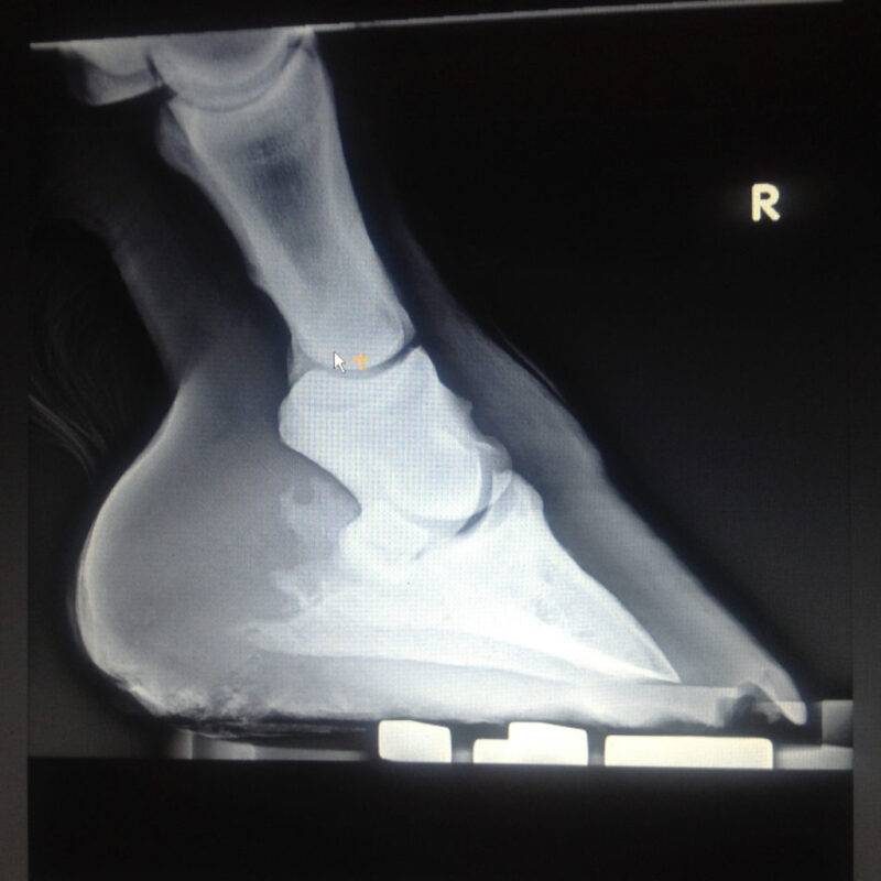 MagRayCloxx Magnetic X-ray Blocks - Podoblock B.V.